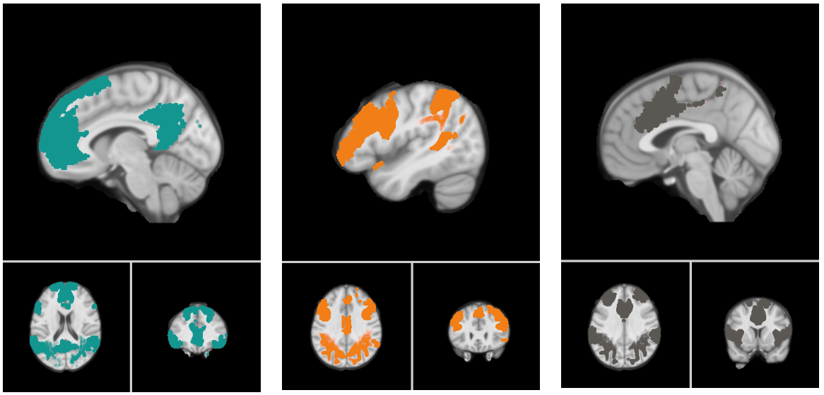 Mémoire : fonctionnement, types & pathologies – Institut du Cerveau