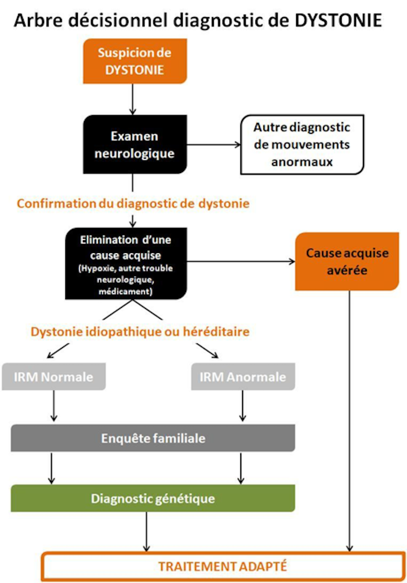Comment diagnostiquer la dystonie ? | Institut du Cerveau