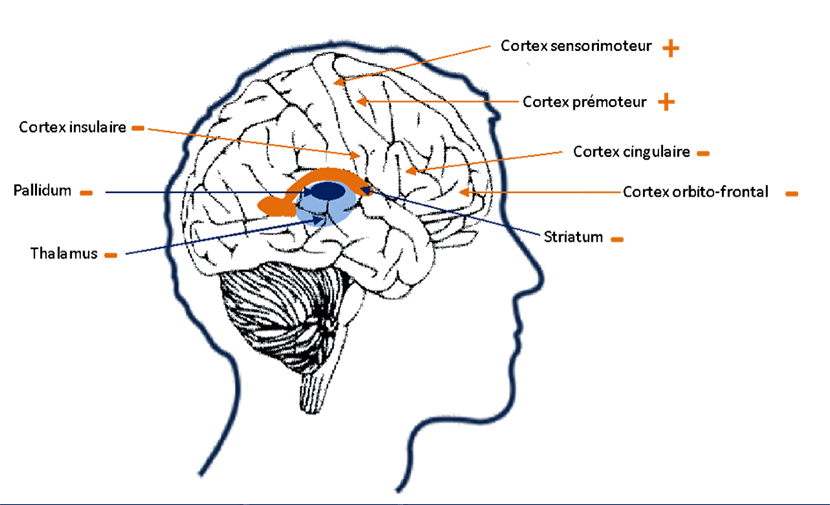 Quels sont les mécanismes biologiques du syndrome de Gilles de la ...