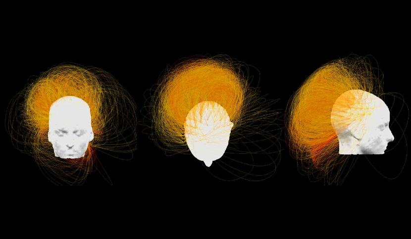 Troubles de la conscience : deux nouvelles découvertes fondamentales ...