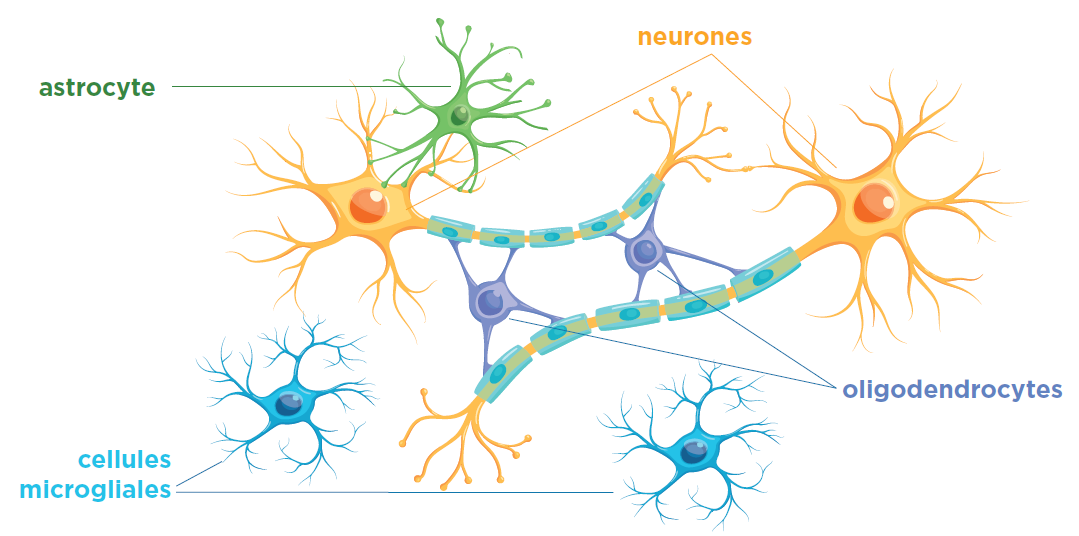 Gliomes | Institut du Cerveau
