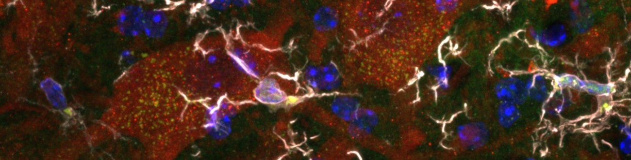 Invincibles ensemble ! : le succès grandissant d’un concert solidaire ...