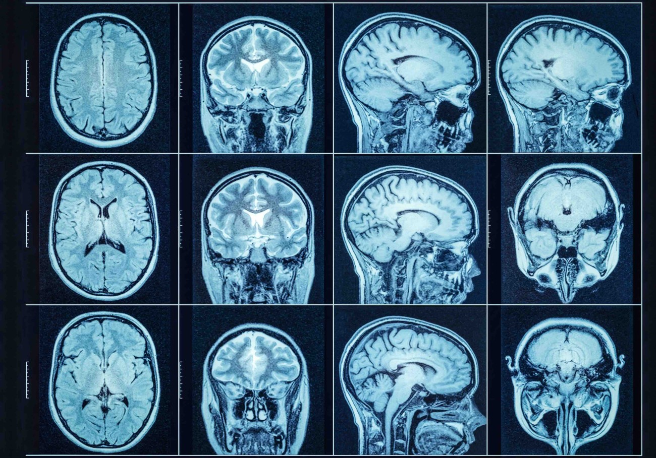 Comment l’architecture du cortex préfrontal façonne notre créativité ...