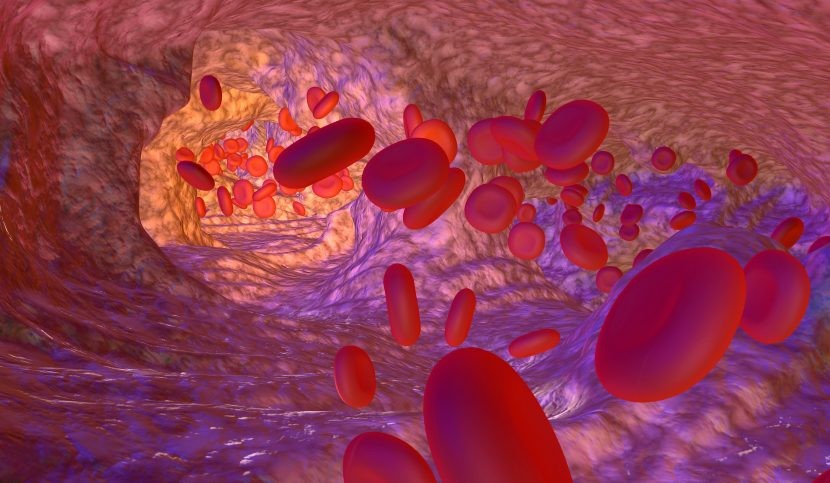 Un simple test sanguin permet désormais de diagnostiquer la maladie de ... Un simple test sanguin permet désormais de diagnostiquer la maladie de ...