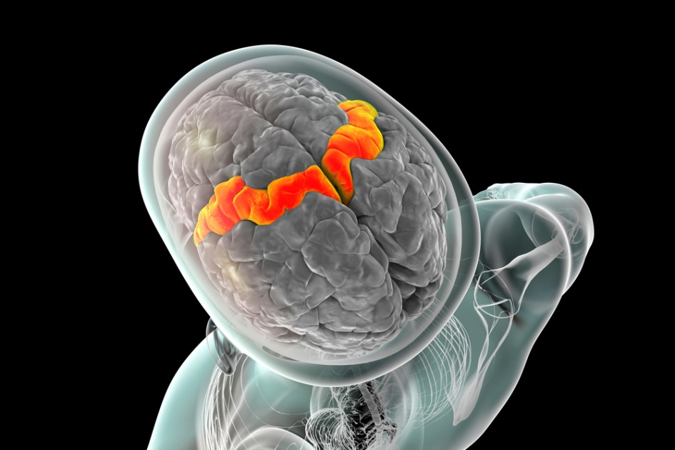 L’origine du syndrome de Lance-Adams enfin élucidée | Institut du Cerveau